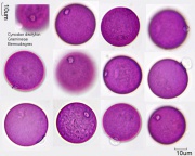 Kategorie:Gramineae – Pollen-Wiki