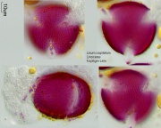 Kategorie:Linaceae – Pollen-Wiki
