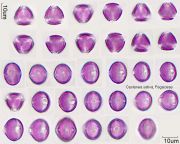 Kategorie:Fagaceae – Pollen-Wiki