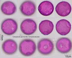 Kategorie:Stephanoporat – Pollen-Wiki