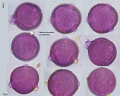 Kategorie:Cucurbitaceae – Pollen-Wiki