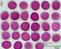 Kategorie:Stephanoporat – Pollen-Wiki