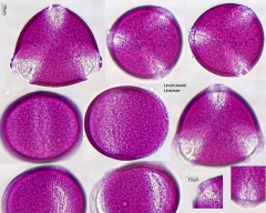 Kategorie:Linaceae – Pollen-Wiki